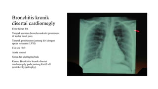 kisi serta soal dan pembahasan osce radiologi | PDF