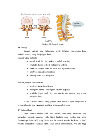 referat neuro stenosis lumbal | DOCX