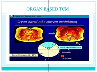 Bismuth shielding . Daniel .J.P , Radiology Technologist , Khorfakhan ...