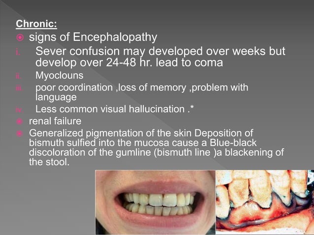 Bismuth toxicity | PPTX