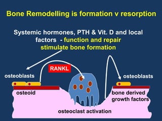 Bisphosphonate lecture lahore malcolm harris | PPT