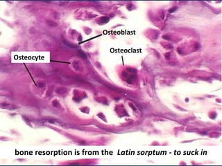 Bisphosphonate lecture lahore malcolm harris | PPT
