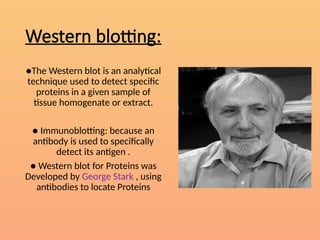 RT-PCR,SDS-PAGE,ELISA AND WESTERN BLOTTING | PPT