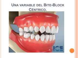 Tratamiento de las maloclusiones con patrón facial hiperdivergente ...