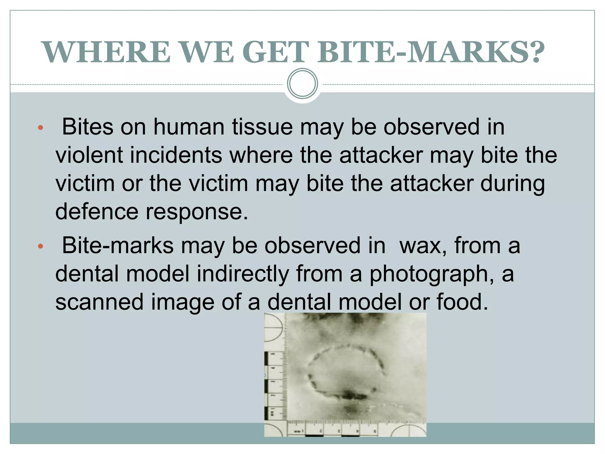 Bitemark | PPTX