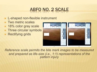 Bite mark | PPTX