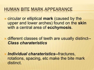 Bite mark | PPTX