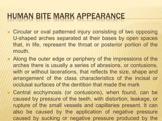 Bite mark | PPTX