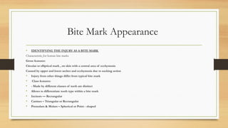 BITE MARK IN FORENSIC ODONTOLOGY , DEPARTMENT OF ORAL MEDICINE AND ...