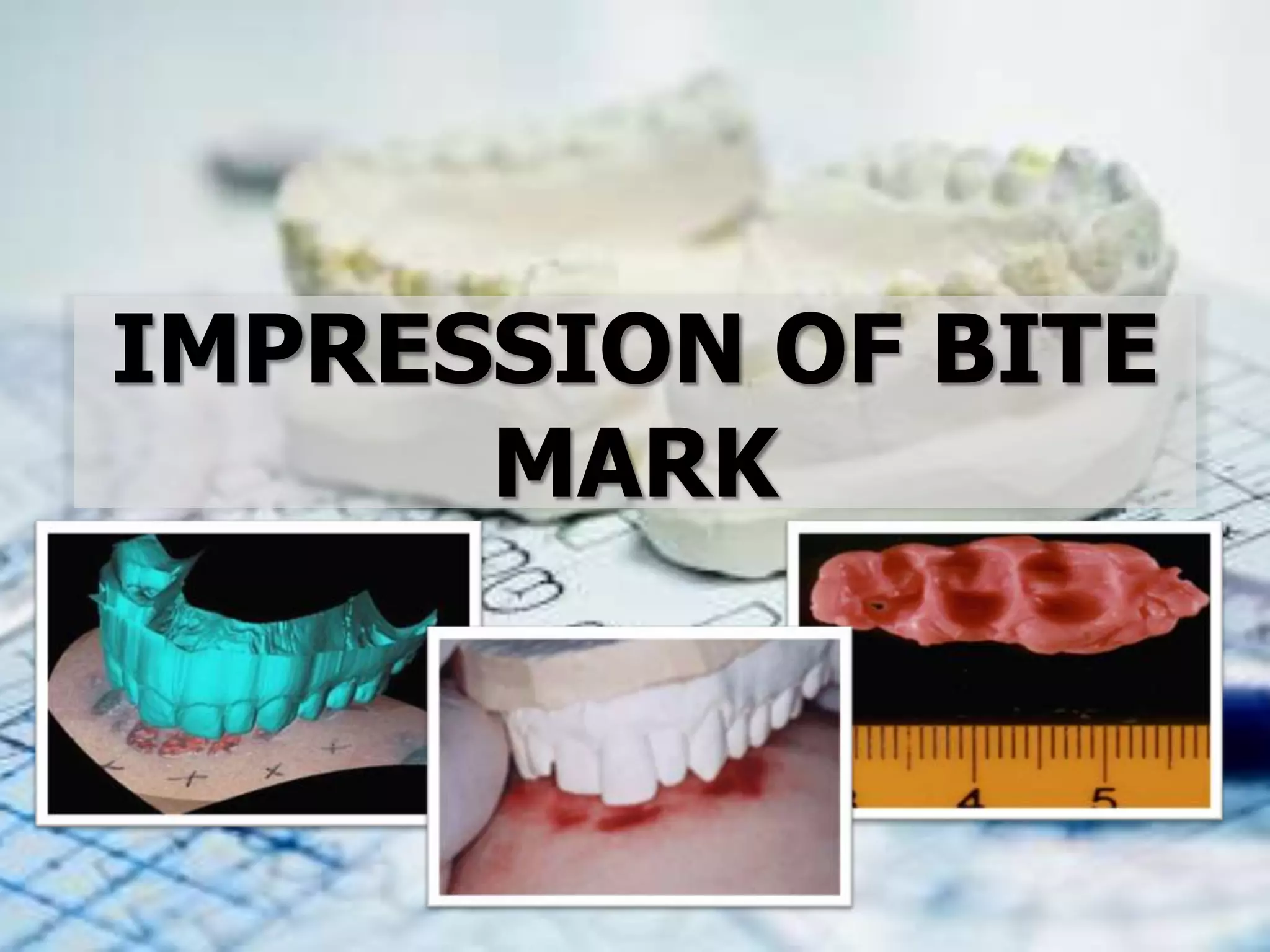Bite mark impression | PPTX