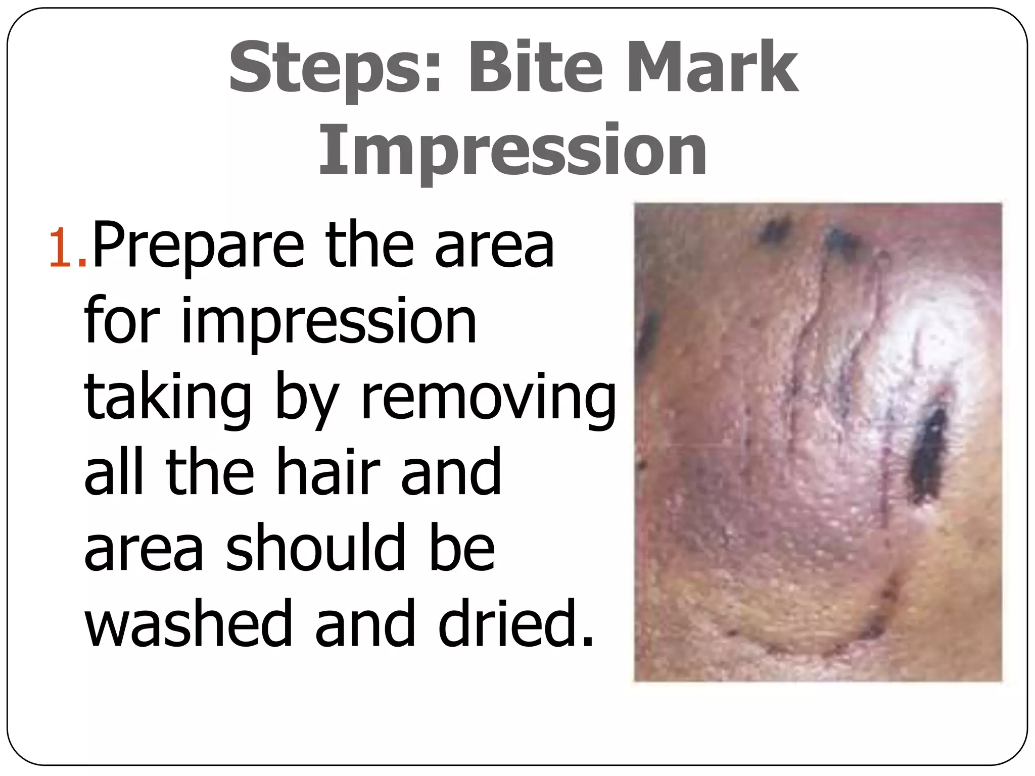 Bite mark impression | PPTX