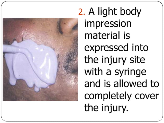 Bite mark impression | PPTX