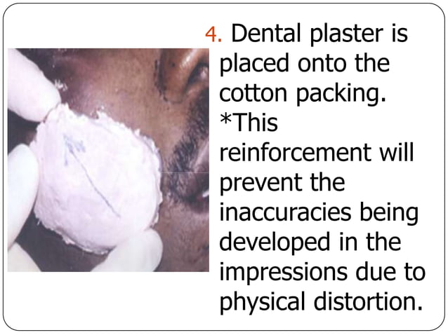 Bite mark impression | PPTX