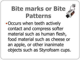 Bite mark impression | PPTX