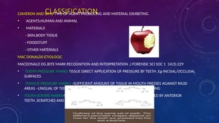 Bite marks in forensic odontology- OMandOR | PPTX