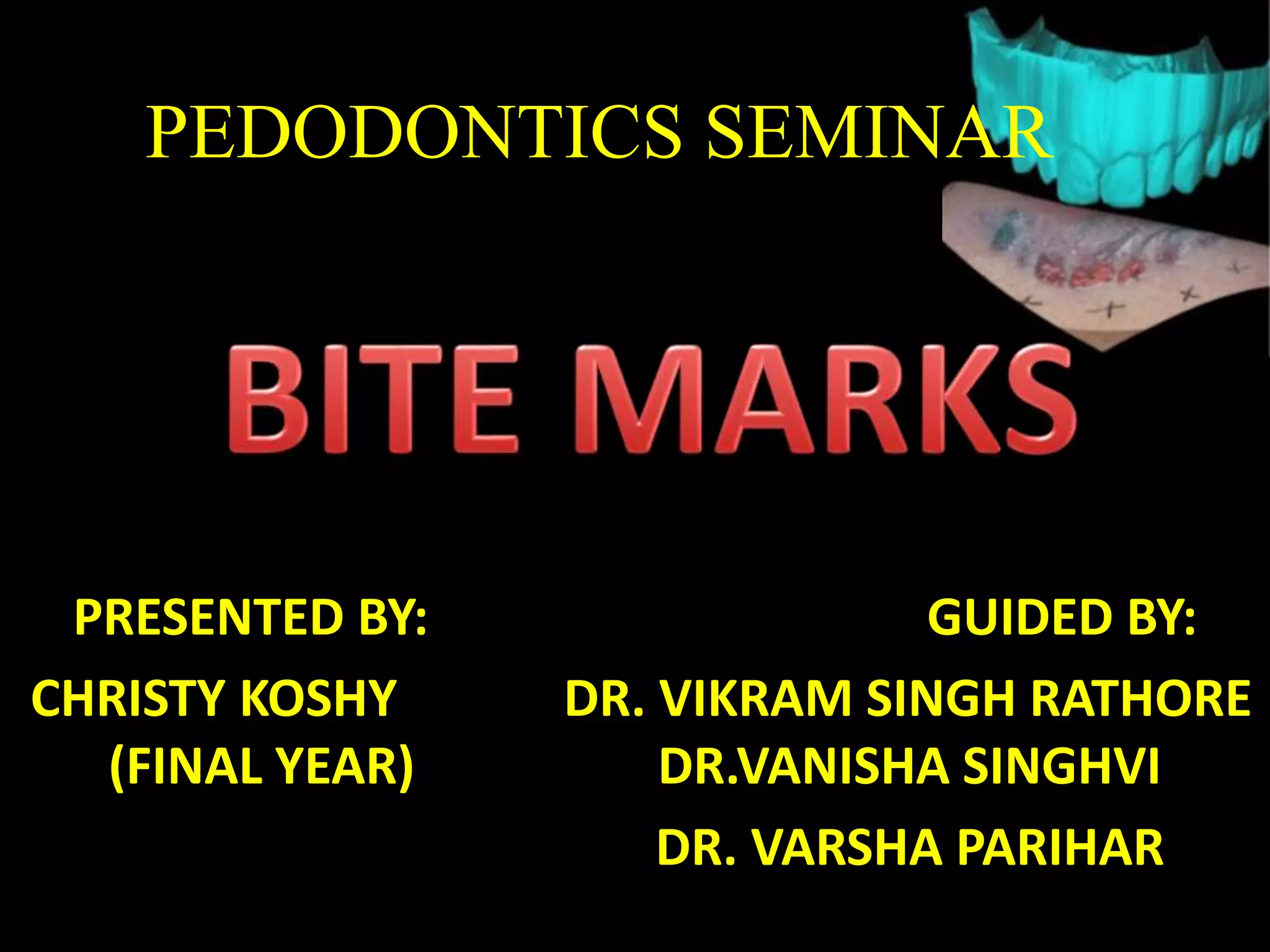 Bite Marks (FORENSIC DENTISTRY) | PPTX