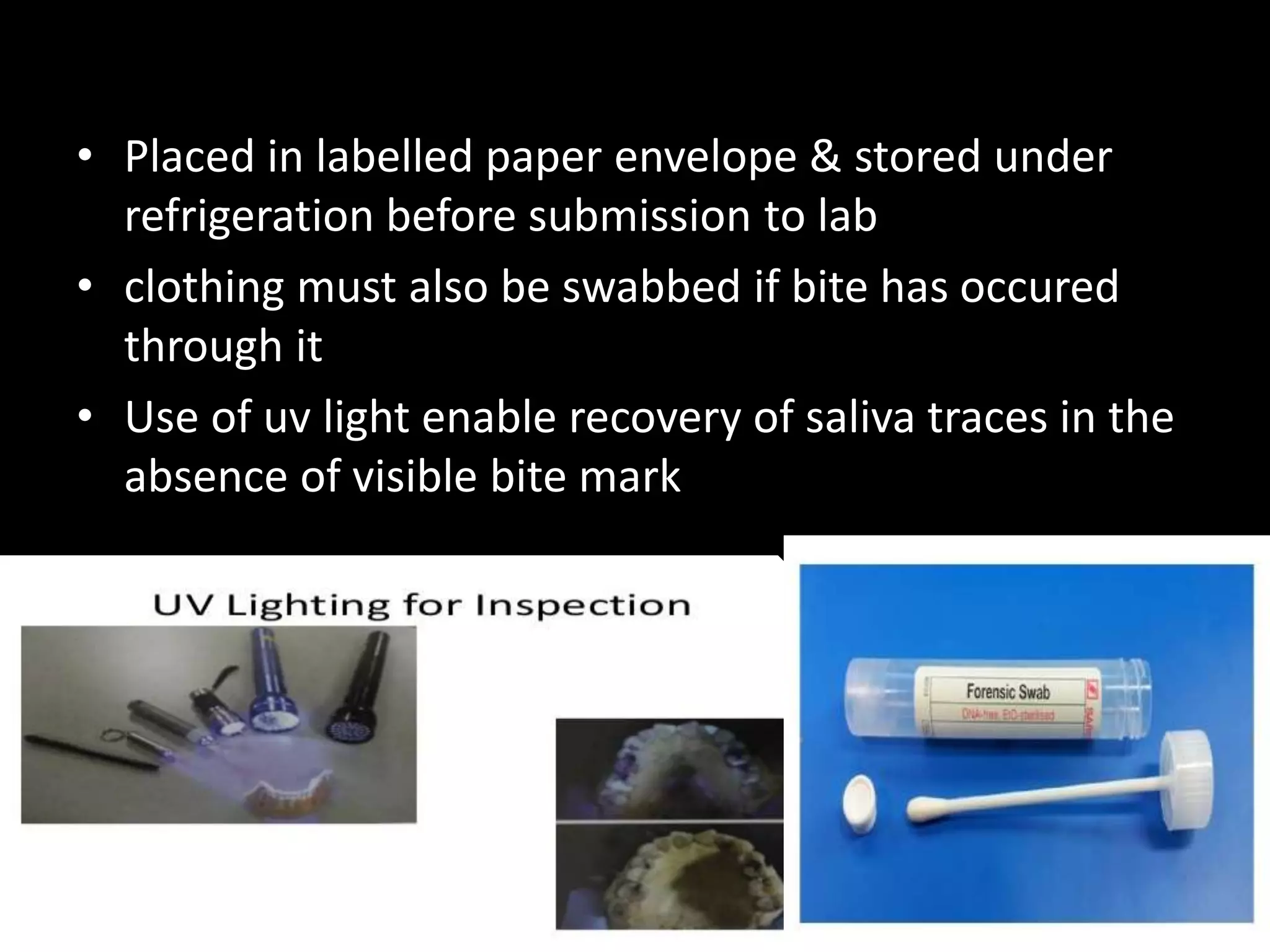 Bite Marks (FORENSIC DENTISTRY) | PPTX