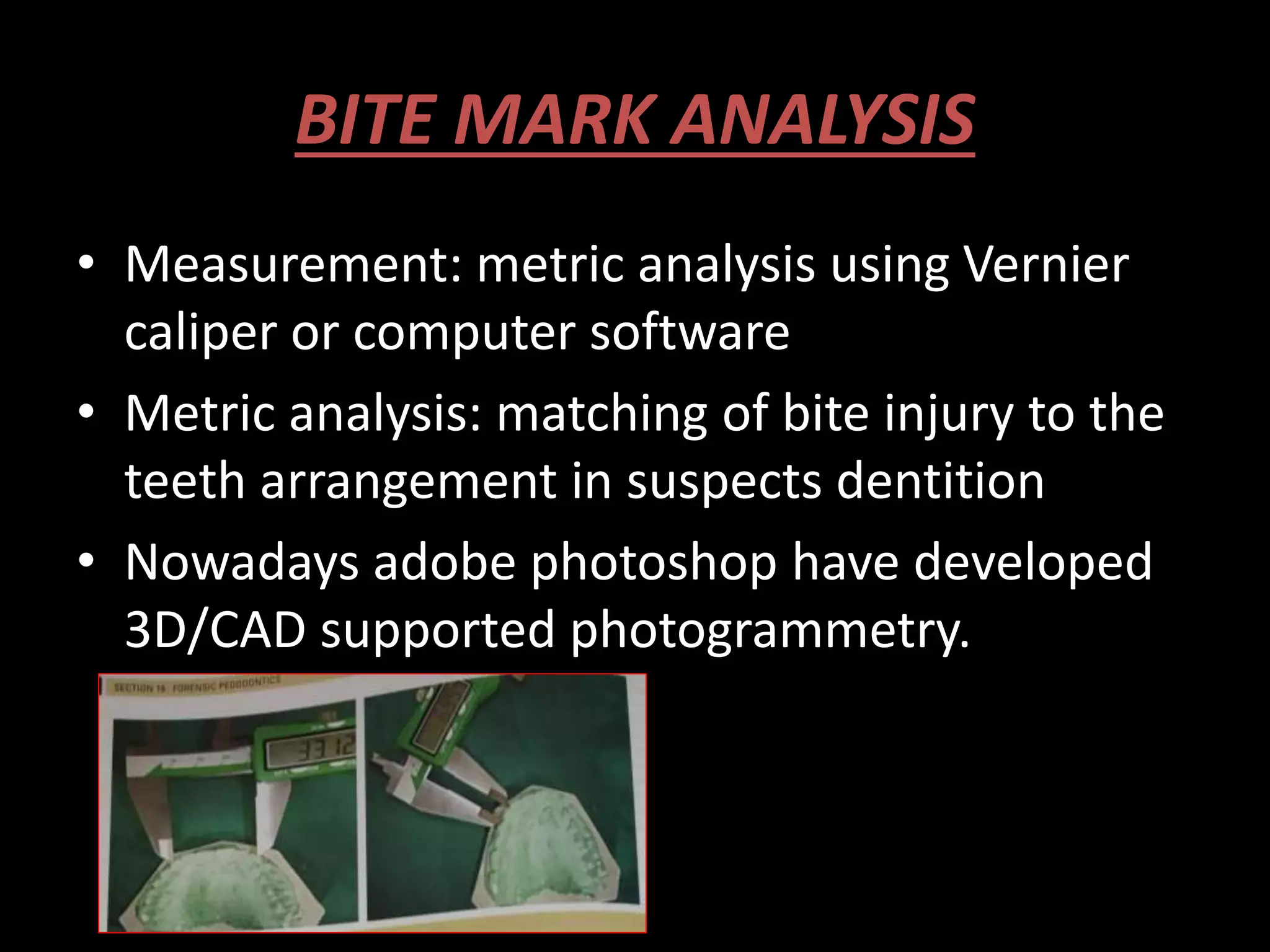 Bite Marks (FORENSIC DENTISTRY) | PPTX