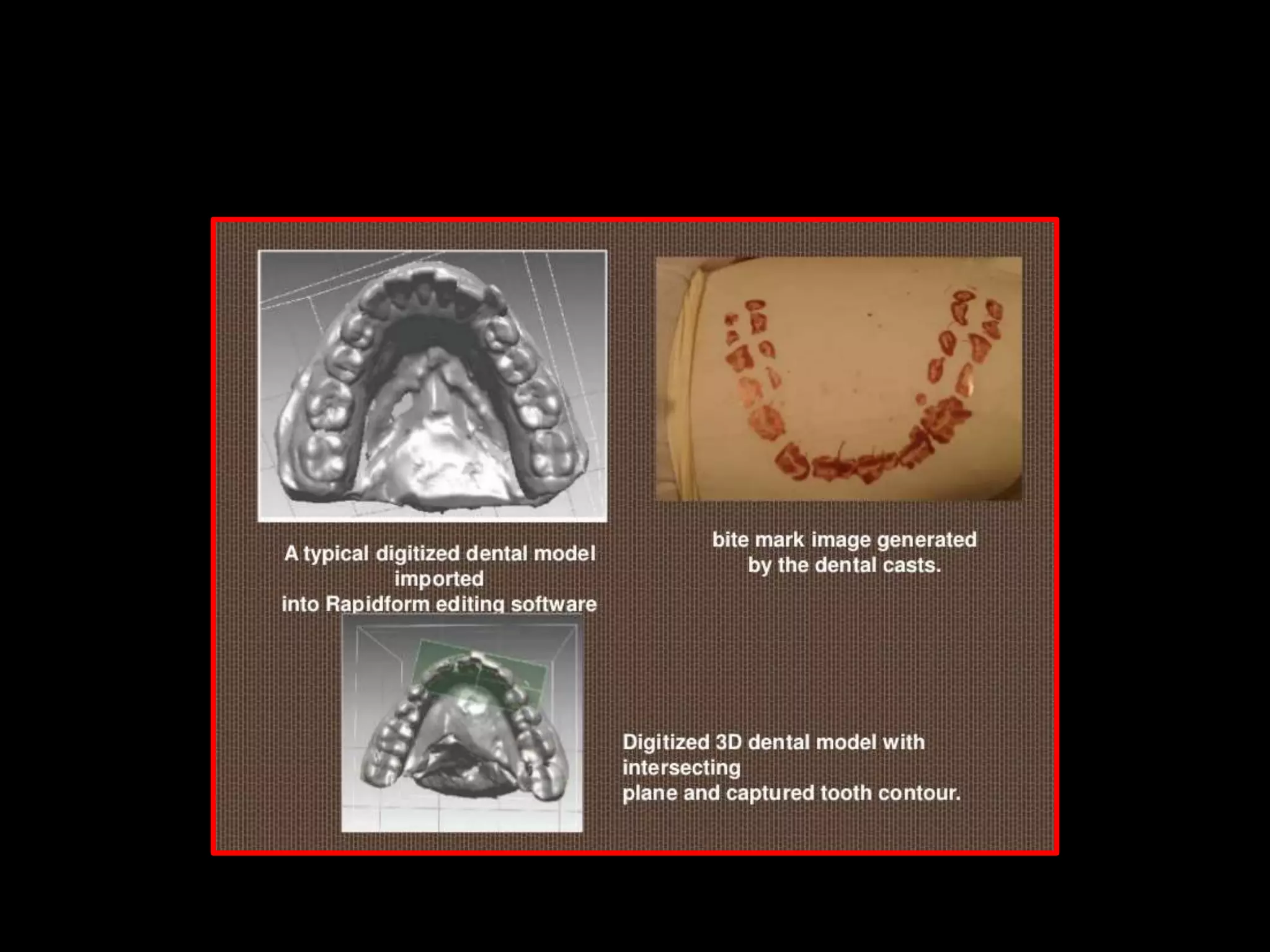 Bite Marks (FORENSIC DENTISTRY) | PPTX