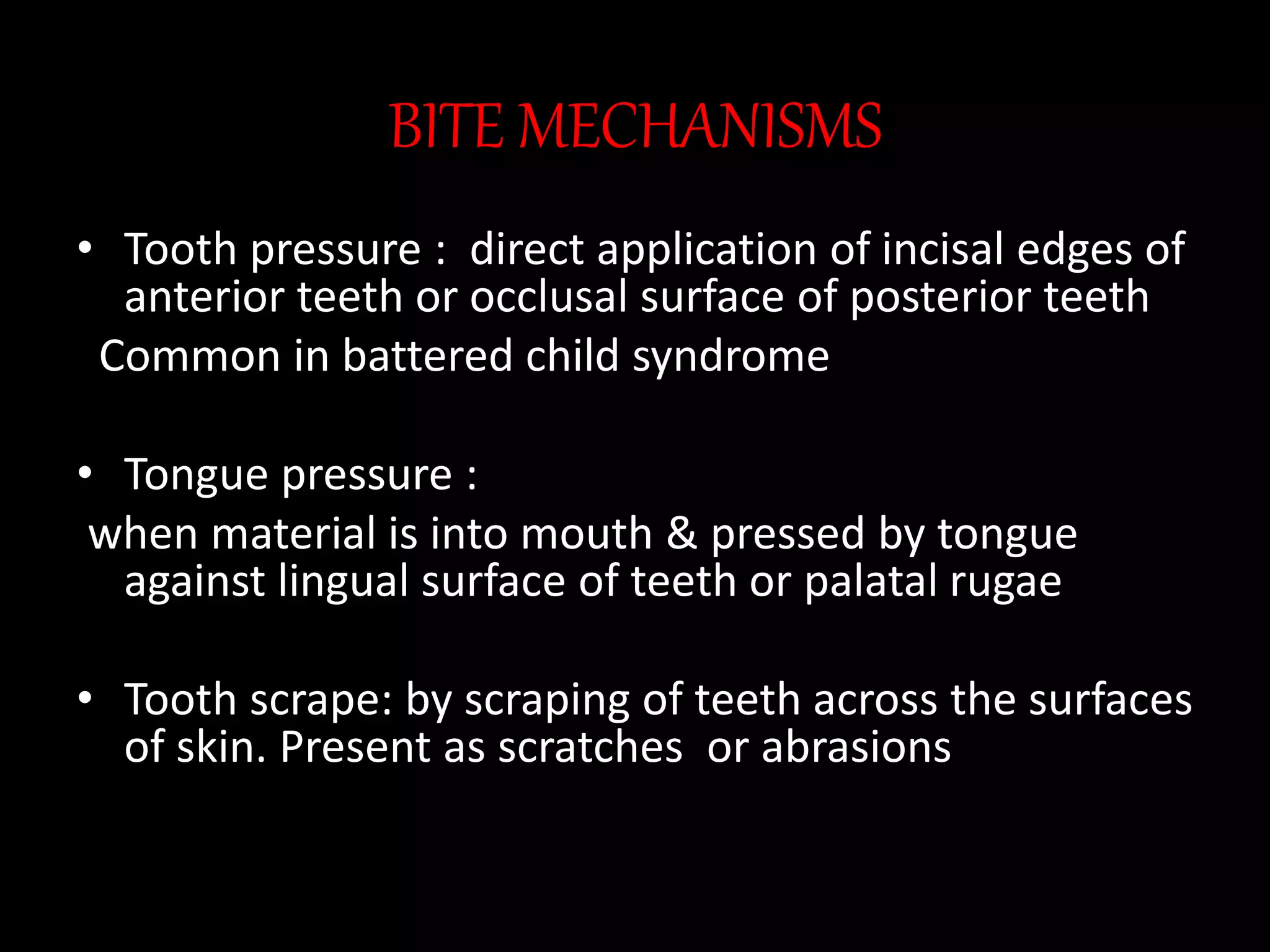 Bite Marks (FORENSIC DENTISTRY) | PPTX