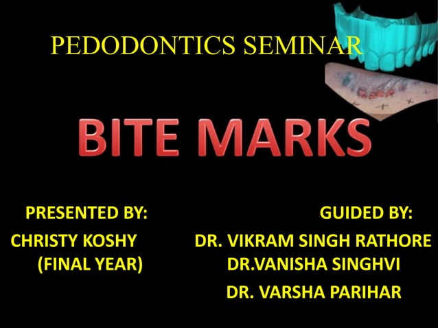 Bite Marks (FORENSIC DENTISTRY) | PPTX
