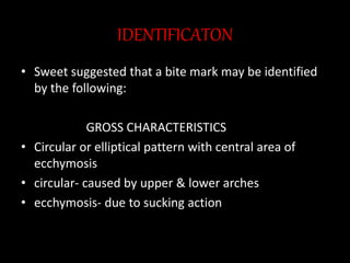 Bite Marks (FORENSIC DENTISTRY) | PPTX