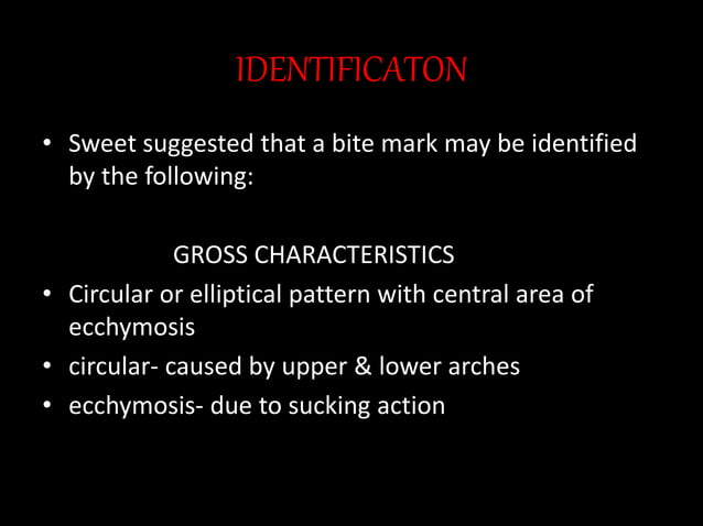Bite Marks (FORENSIC DENTISTRY) | PPTX