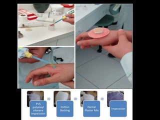 Bite Marks (FORENSIC DENTISTRY) | PPTX