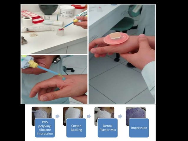 Bite Marks (FORENSIC DENTISTRY) | PPTX