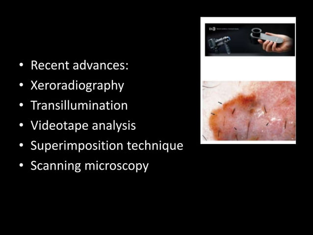 Bite Marks (FORENSIC DENTISTRY) | PPTX