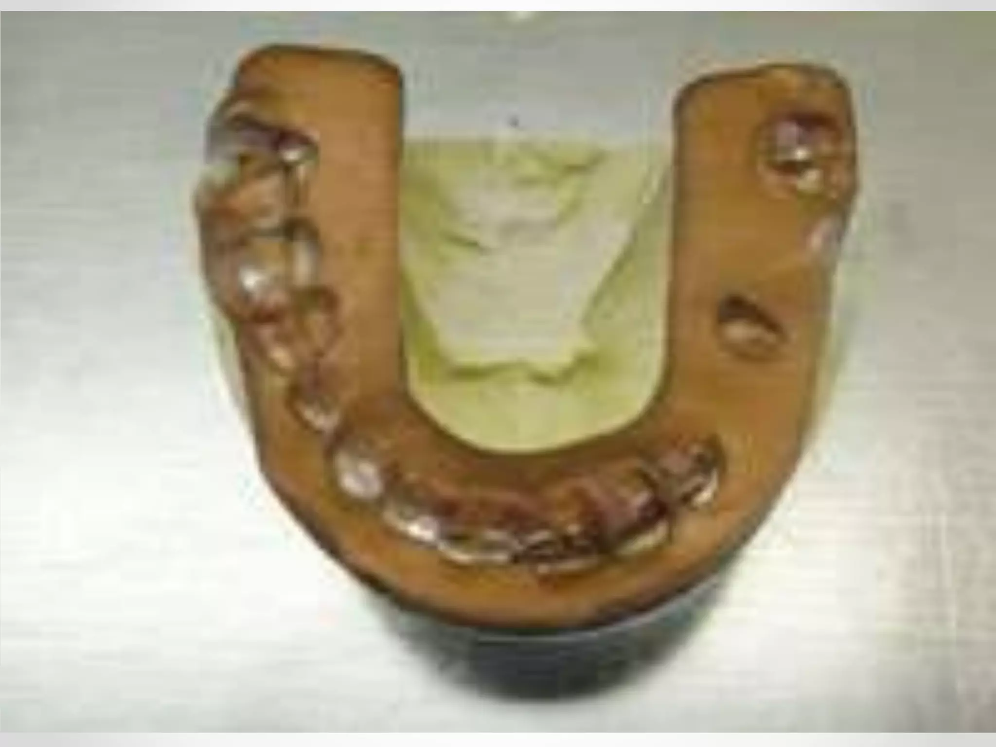 bite registeration.pptx