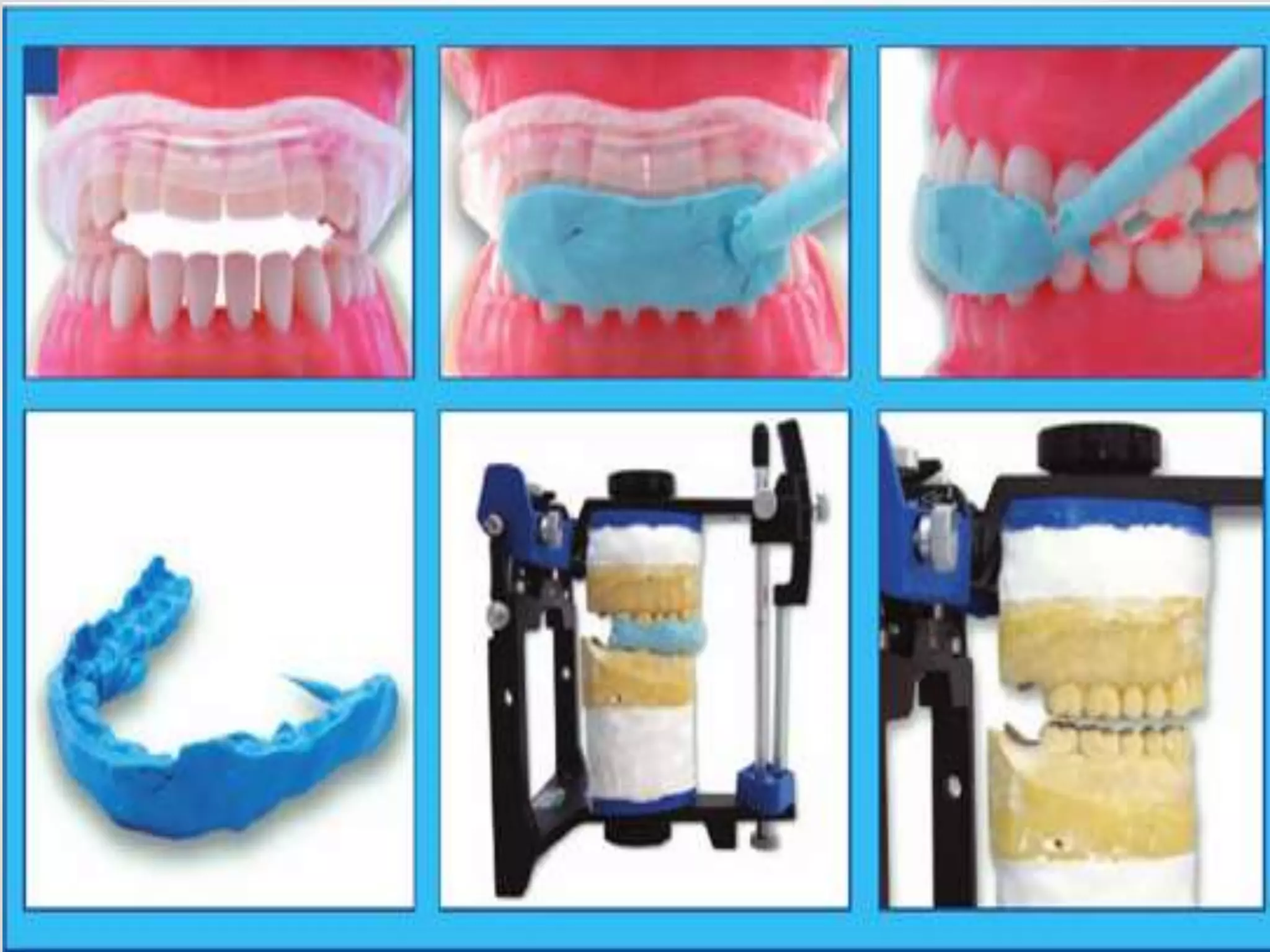 bite registeration.pptx