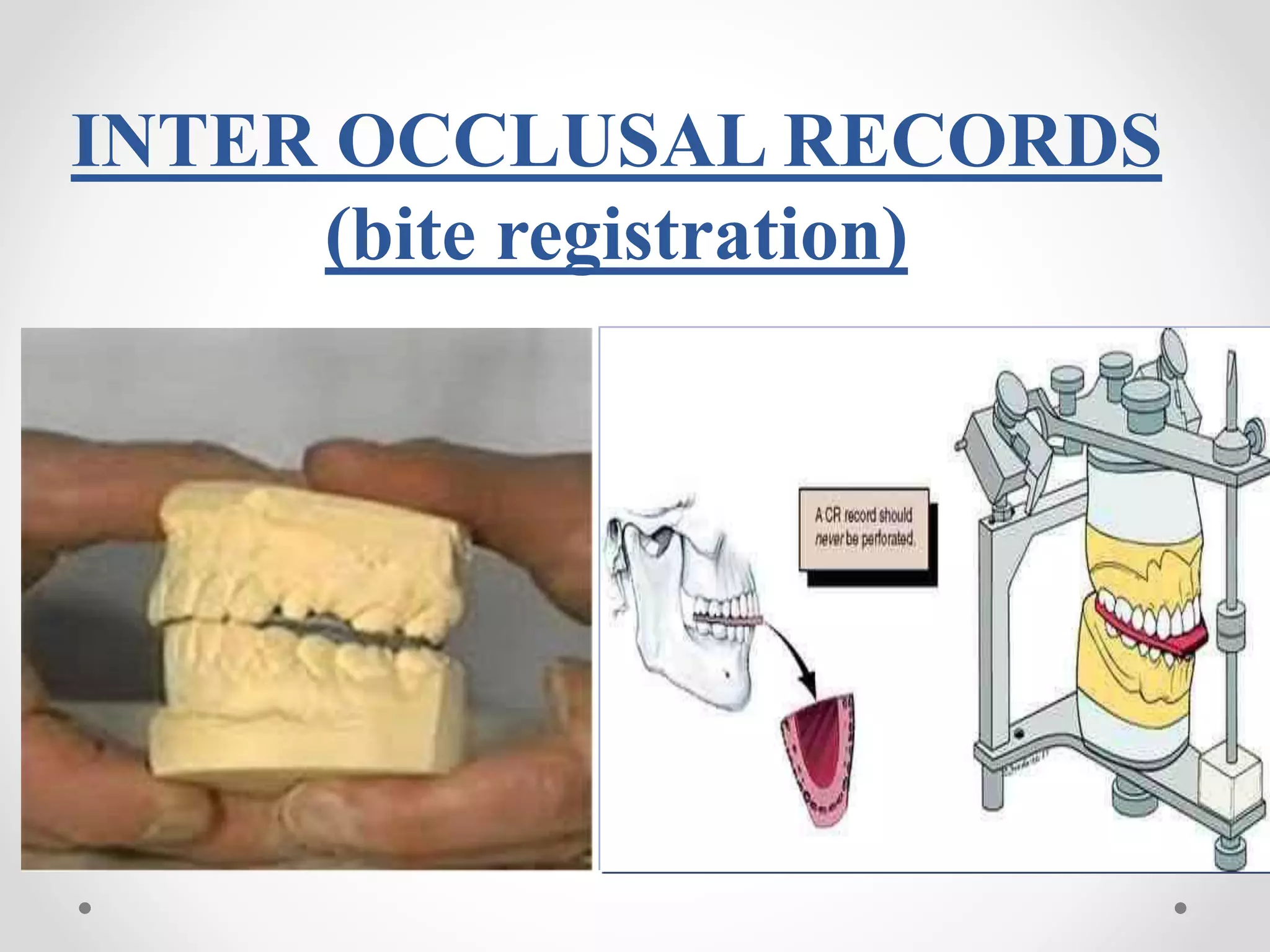 bite registeration.pptx