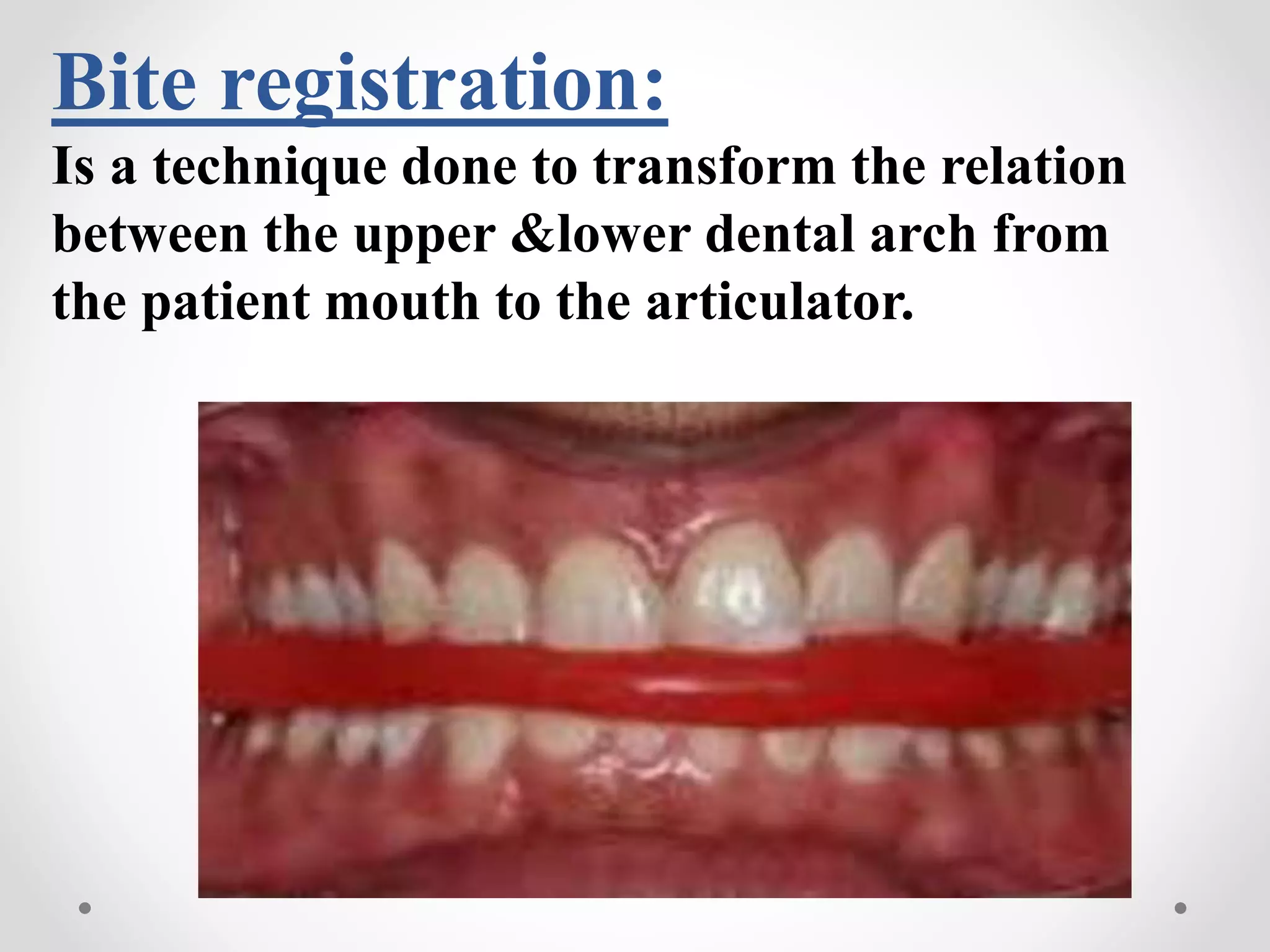 bite registeration.pptx