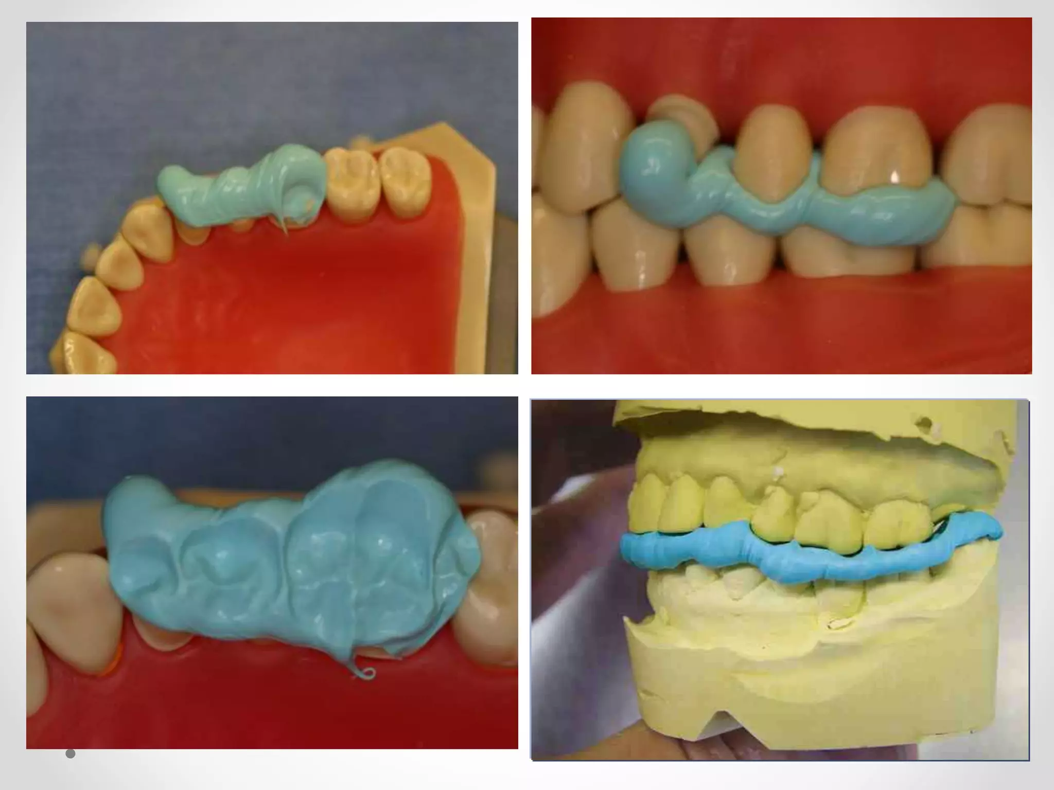 bite registeration.pptx