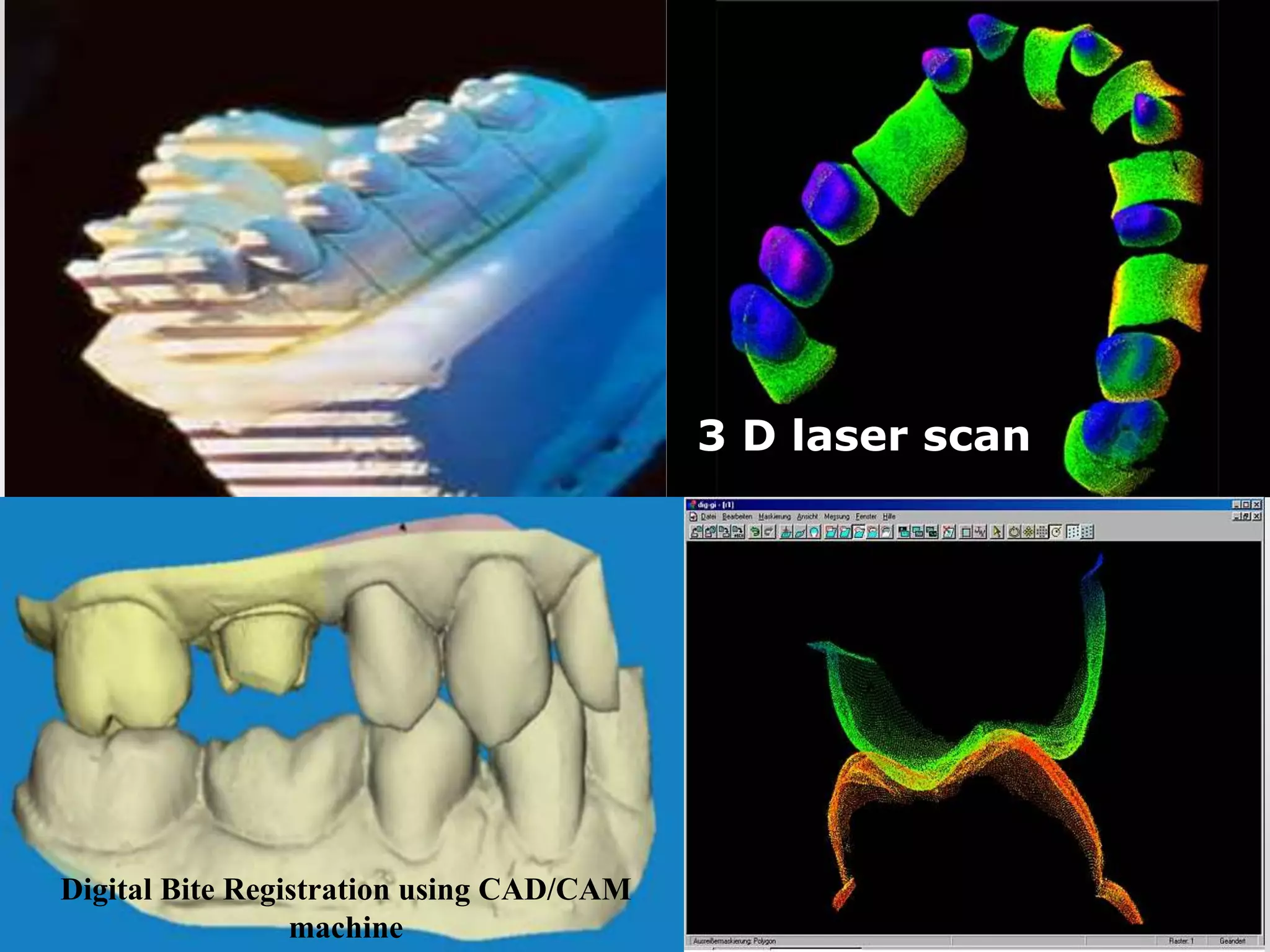 bite registeration.pptx