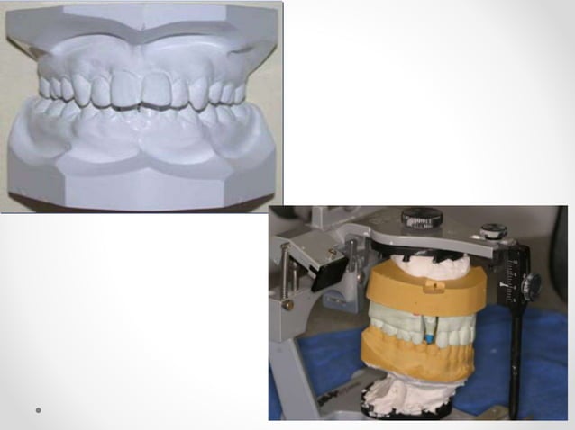 bite registeration.pptx