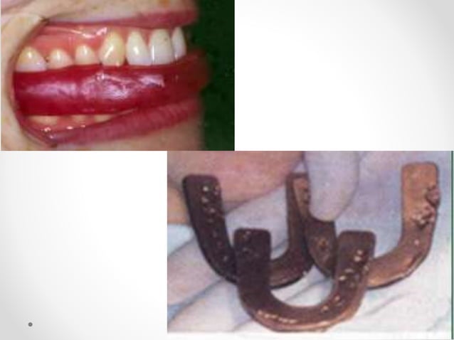 bite registeration.pptx