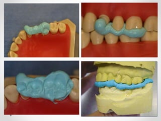 bite registeration.pptx