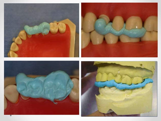 bite registeration.pptx