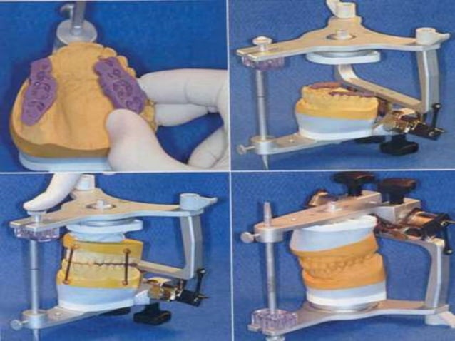 bite registeration.pptx