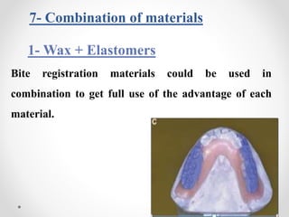 bite registeration.pptx