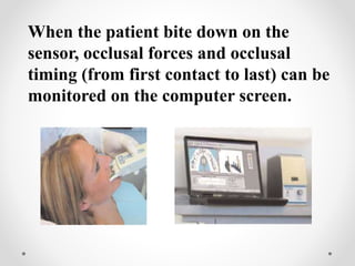 bite registeration.pptx