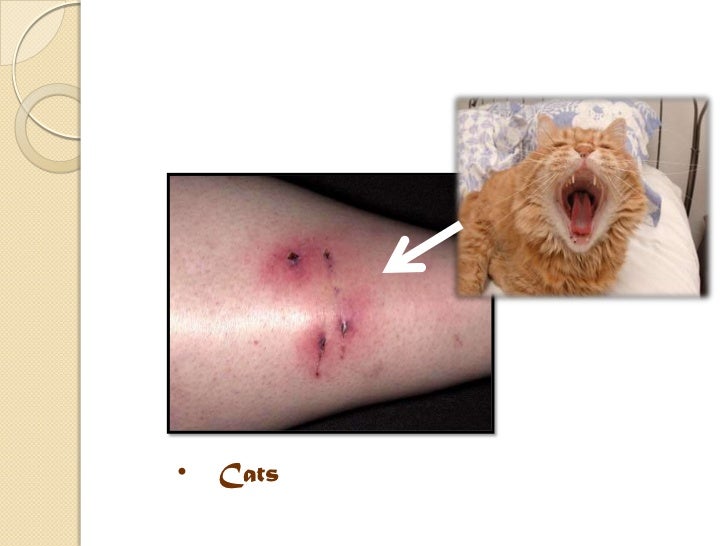 Disgusting Animal Bites