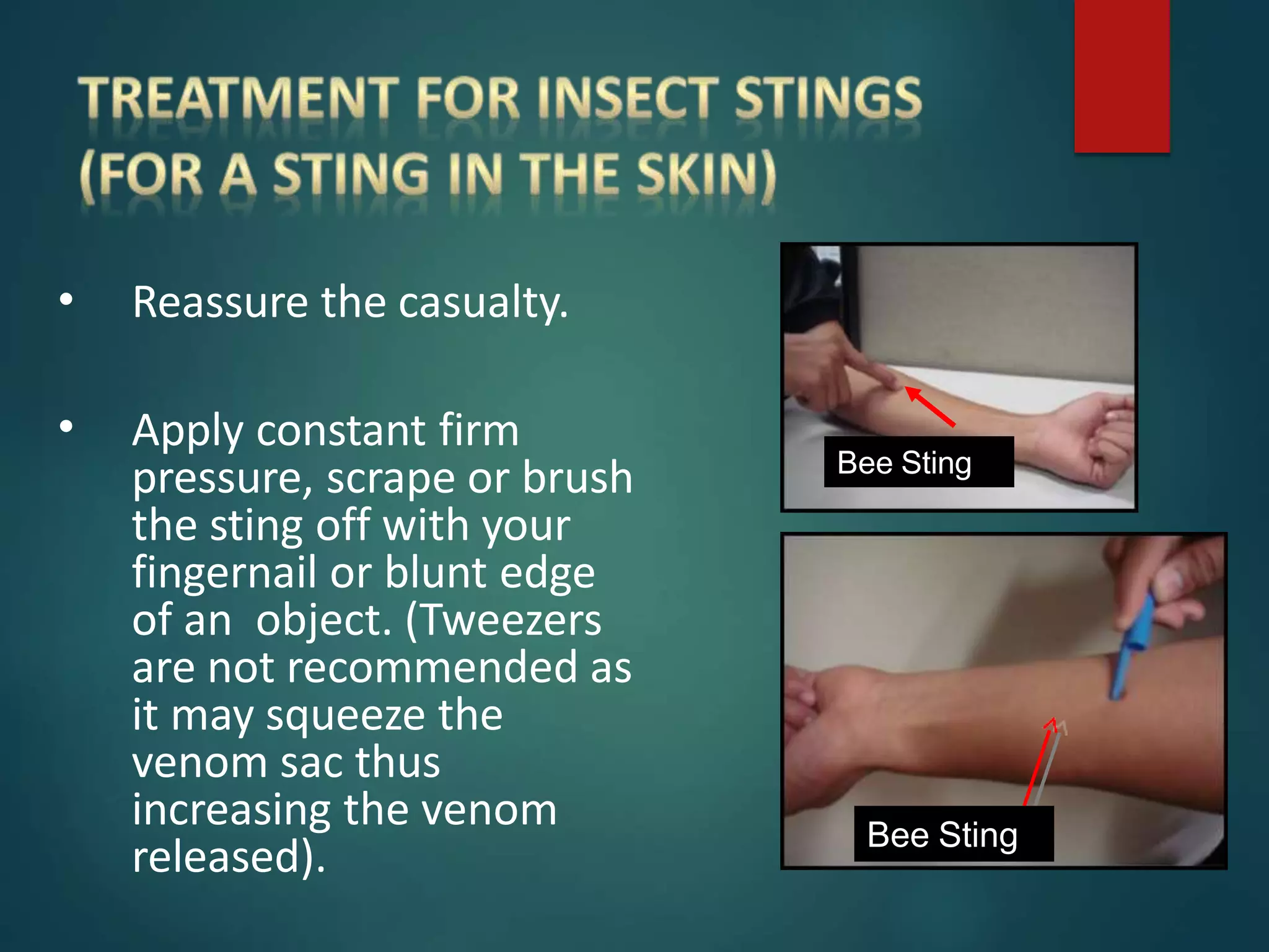 BITES AND STINGS.pptx
