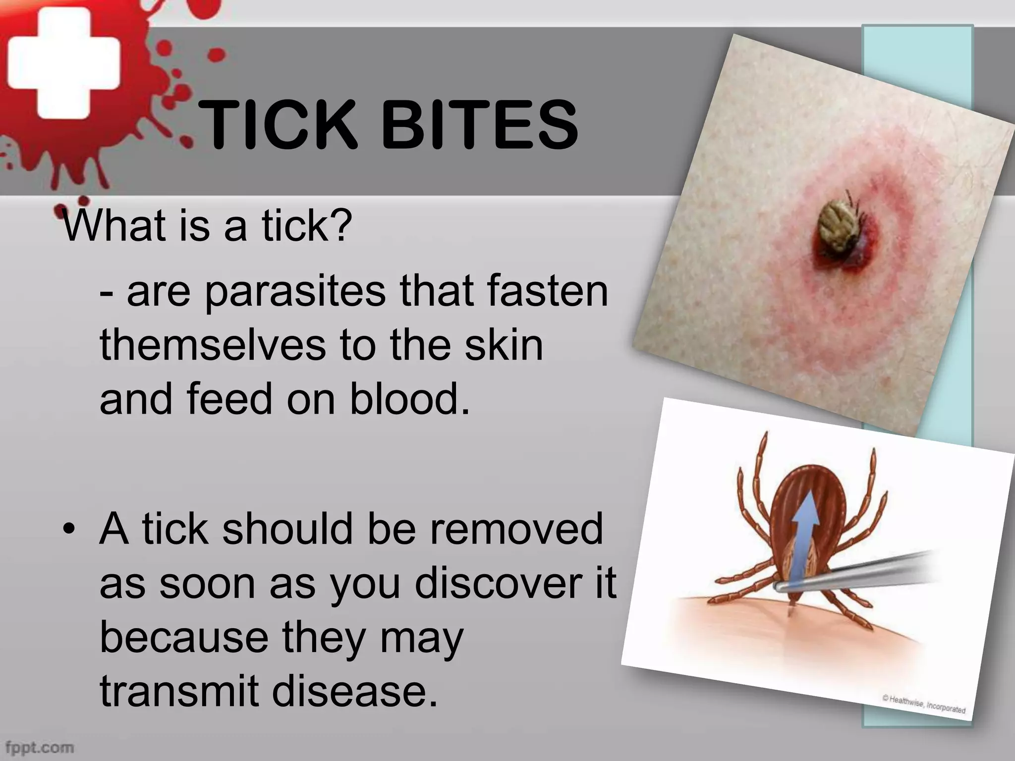 Bites first aid | PPTX