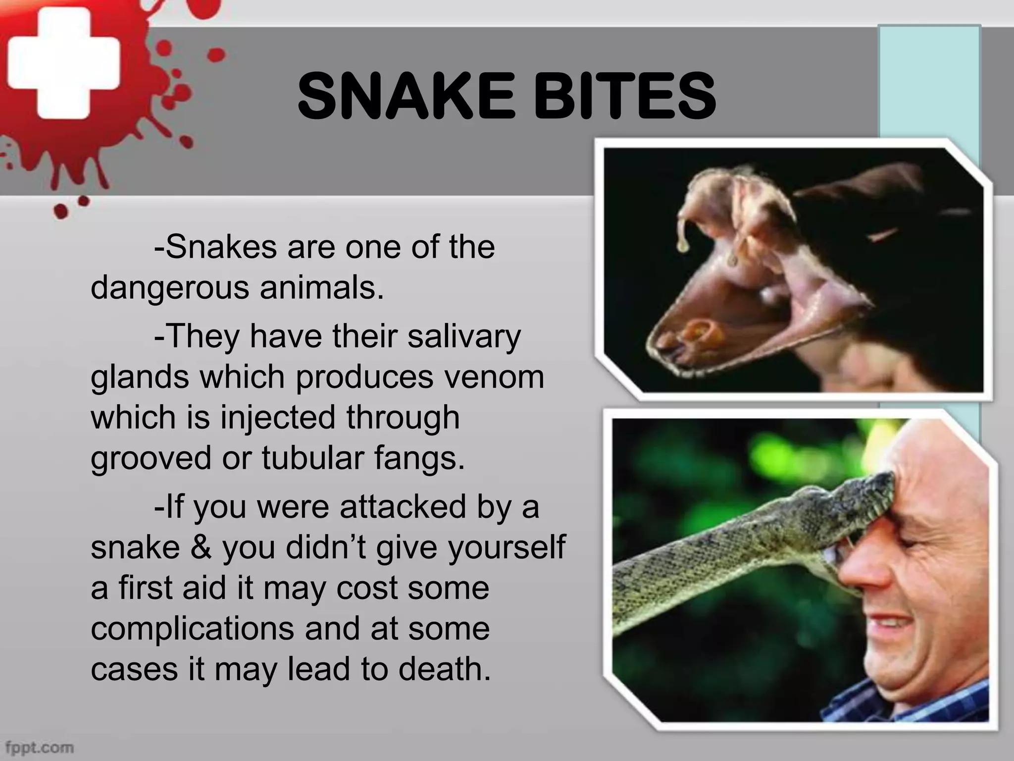 Bites first aid | PPTX