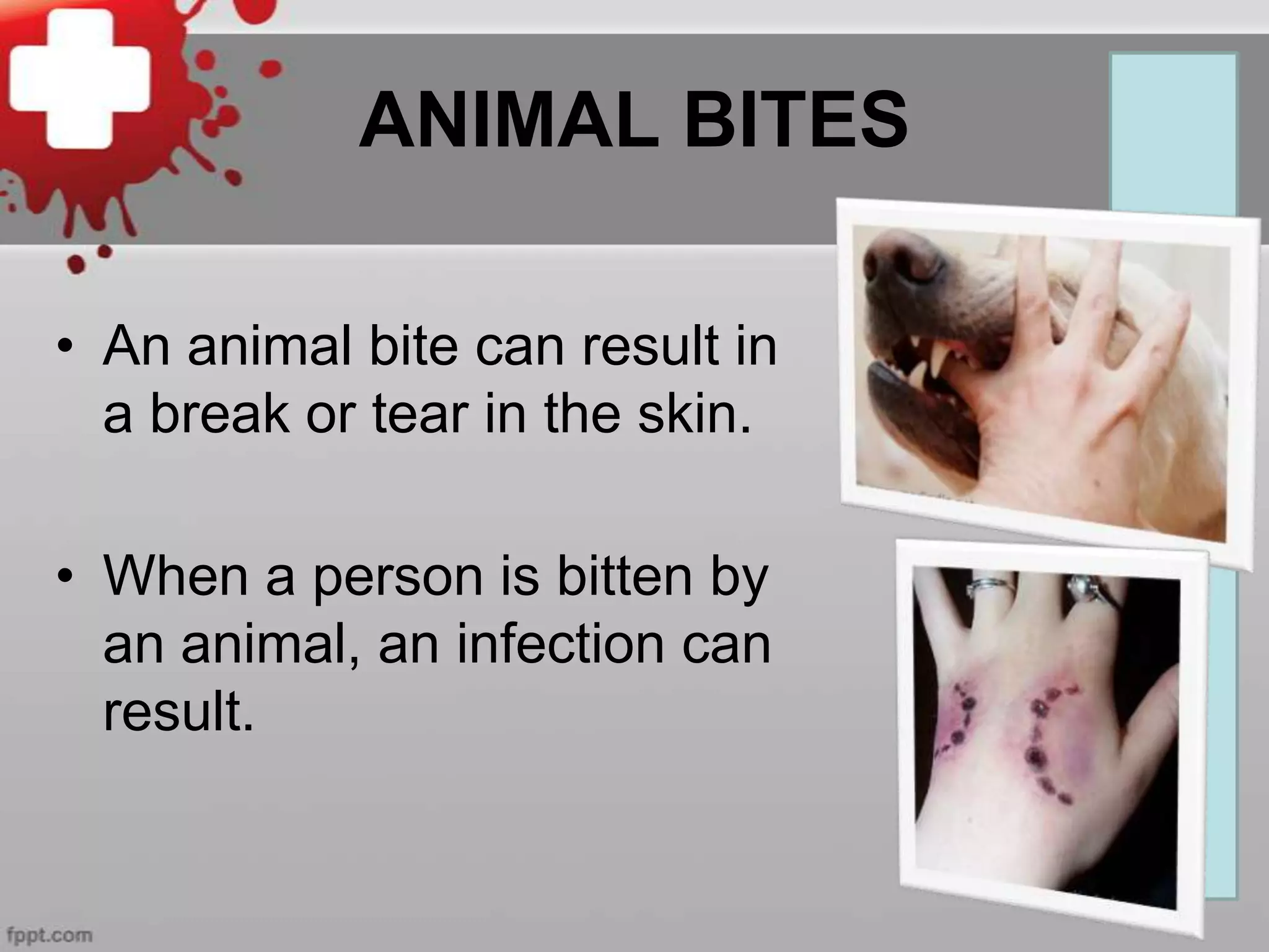 Bites first aid | PPTX