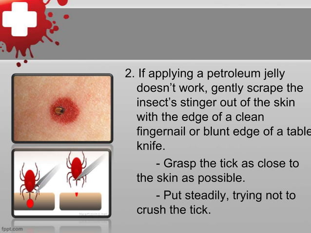 Bites first aid | PPTX