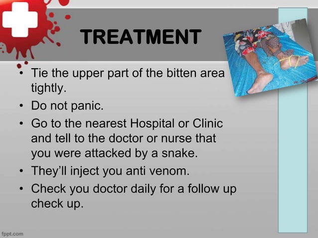 Bites first aid | PPTX